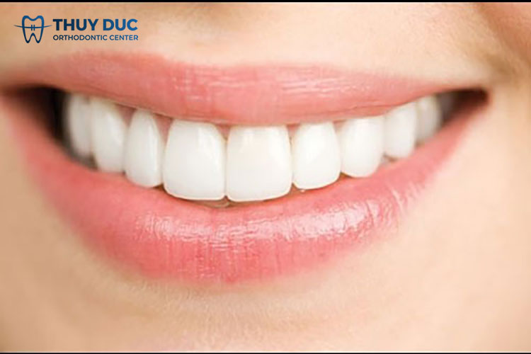 Xem tướng người răng hô chính xác nhất